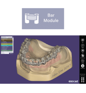 Exocad Software: Ultimate Package + FREE Training // Evolve Dentistry™