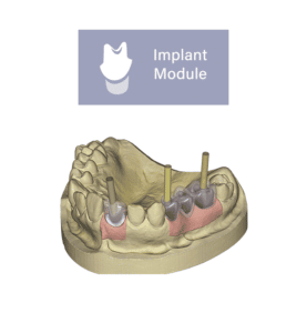 Exocad Software: Ultimate Package + FREE Training // Evolve Dentistry™