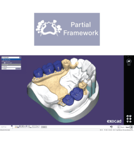 Exocad Software: Ultimate Package + FREE Training // Evolve Dentistry™