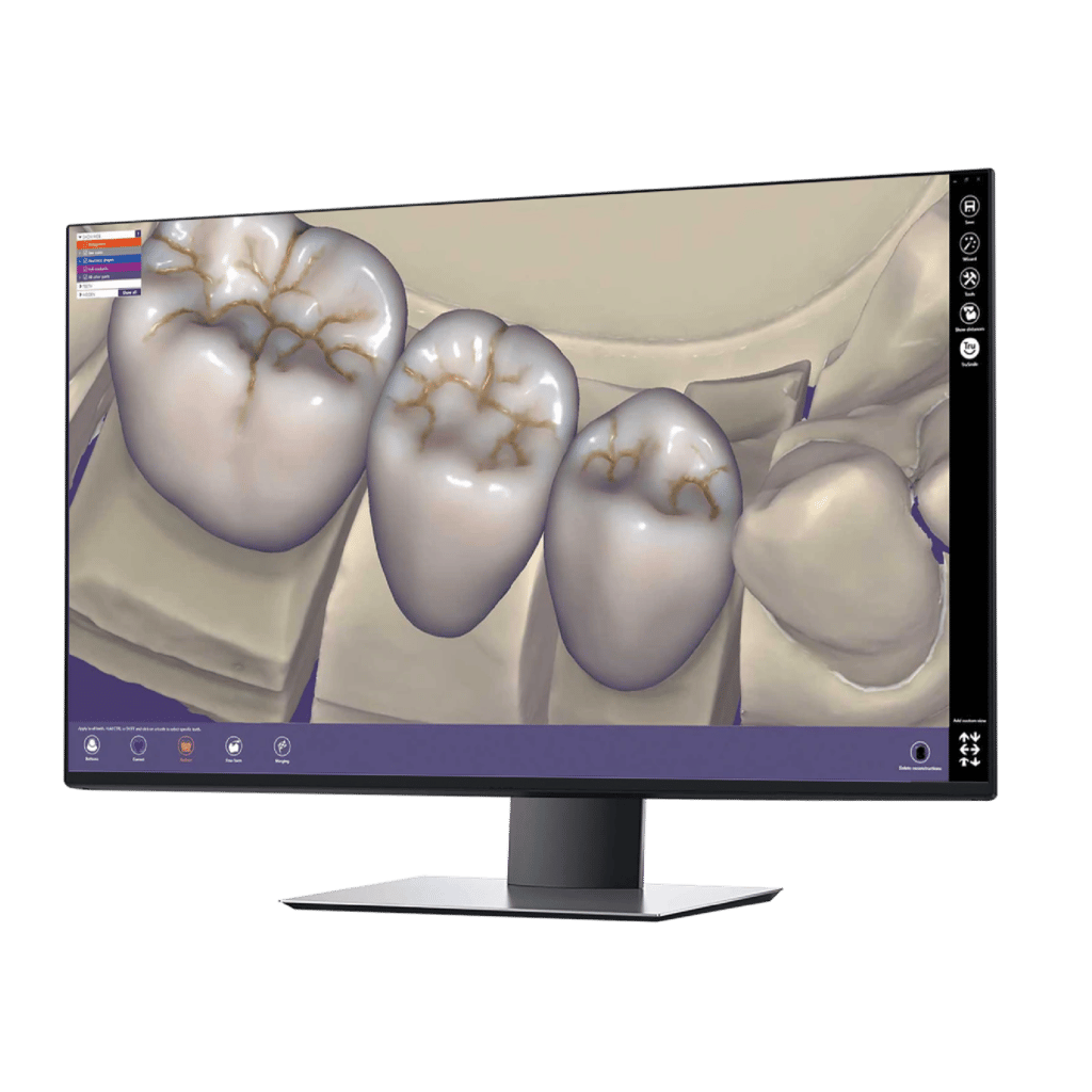iCam 4D Implant Scanner | Evolve Dentistry