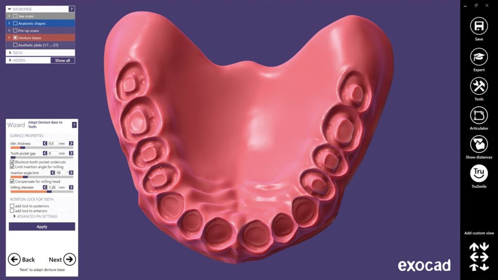 Full Denture | Evolve Dentistry