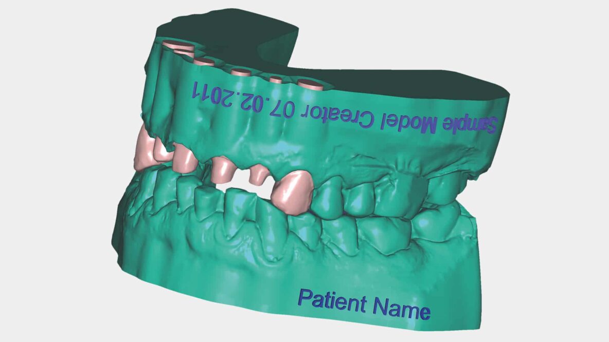 Model Creator | Evolve Dentistry