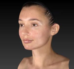 Vectra H2 Facial Scanner | Evolve Dentistry