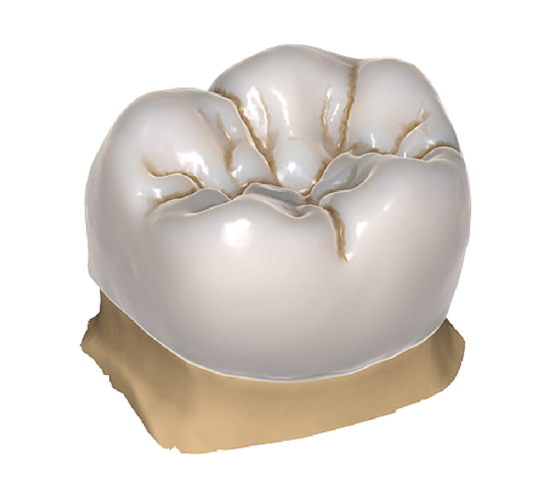 Evolve Dentistry: USA's Trusted Dental CAD/CAM Reseller